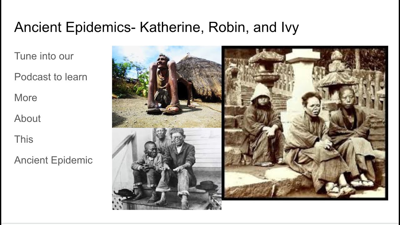 Ancient Epidemics: Katherine, Robin, and Ivy - YouTube