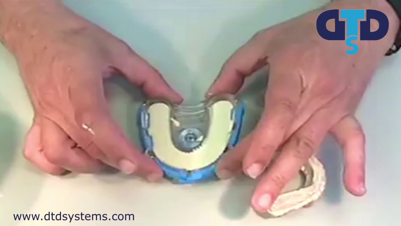 Modelo en BAFIX a partir de un modelo ya vaciado - DTD systems - YouTube