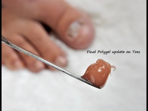 POLYGEL TOENAILS ( Dual Forms ) ---- FINAL UPDATE --- Not IMPRESSED ...