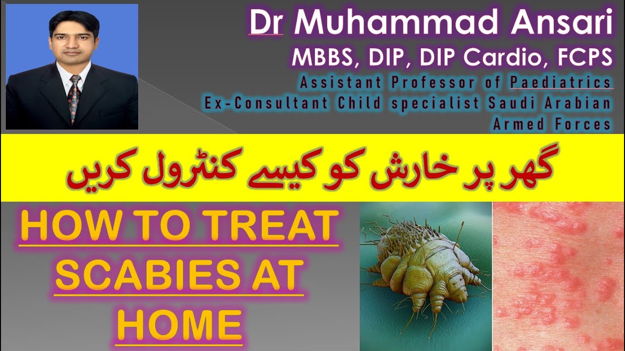 How to get rid of scabies, خارش کے مرض سے جان کیسے چھڑائیں. Dr Ansari ...