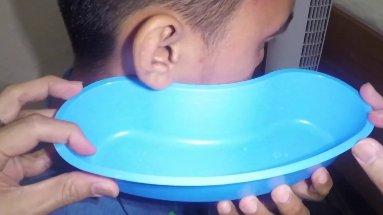 Removing Young Man's Earwax Plug By Ear Irrigation - YouTube