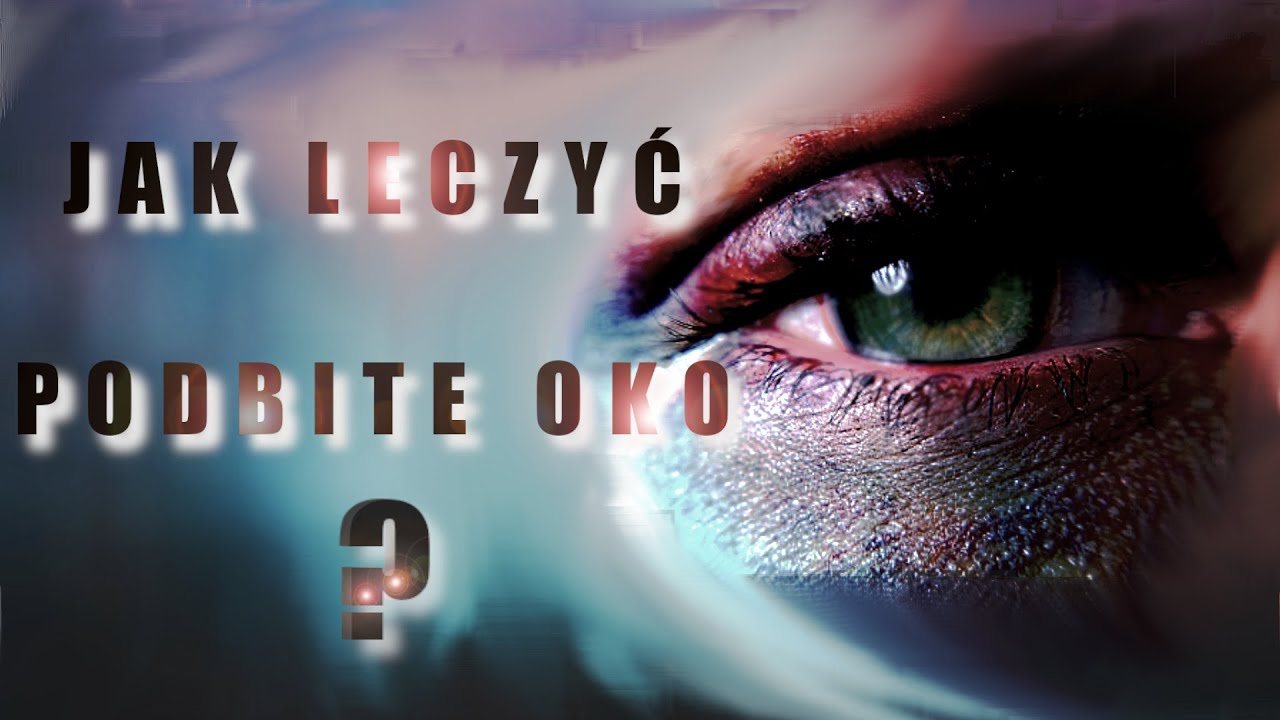 Jak leczyć podbite oko(szybciej) - YouTube