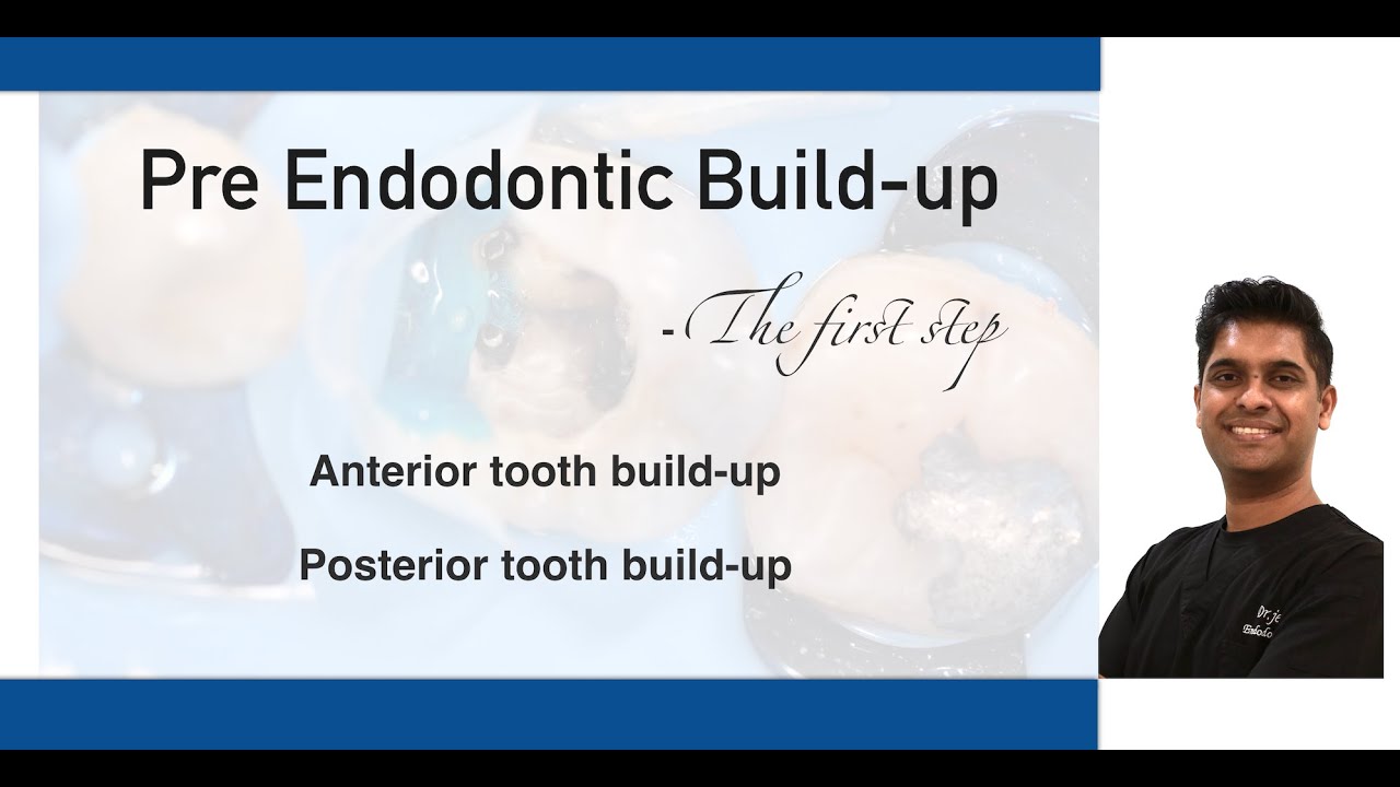 Pre endodontic build up - YouTube