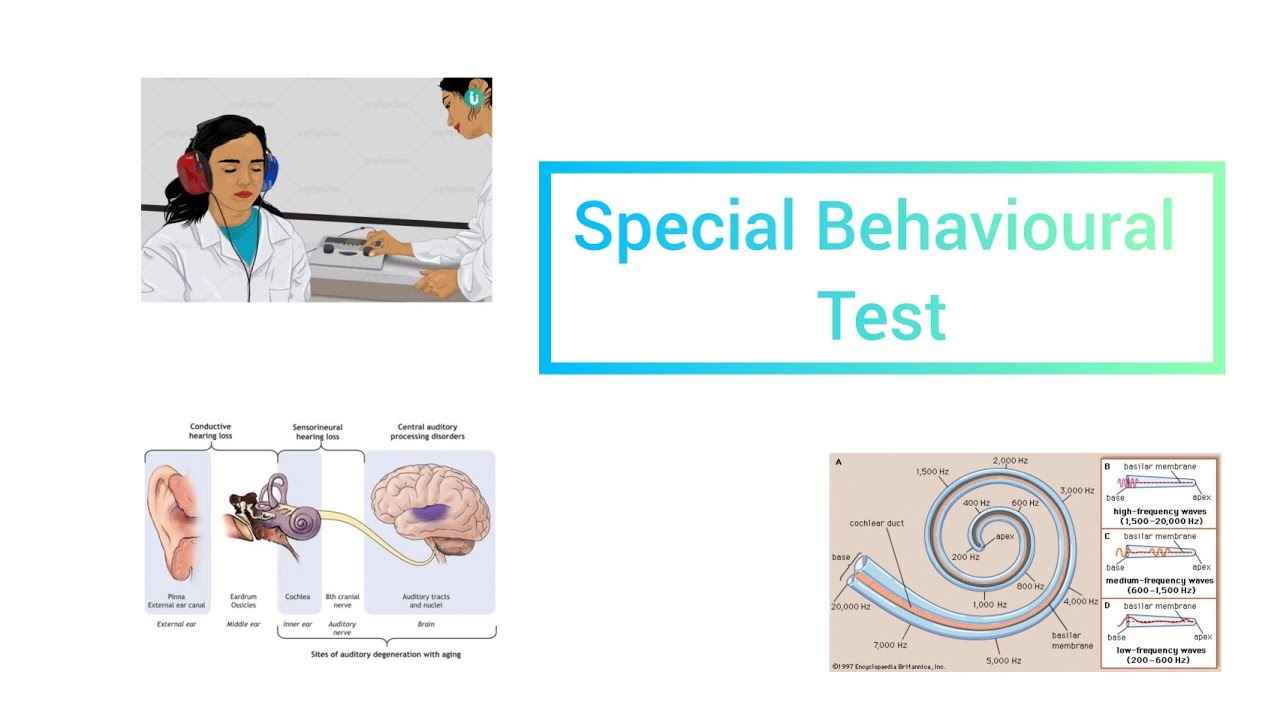 Special Behavioural Test for CP and RCP (cochlear and retrocochlear ...