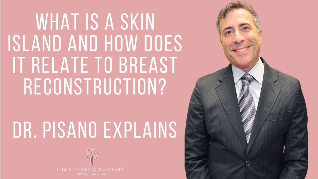 What is a Skin Island and How is it Used in Breast Reconstruction ...