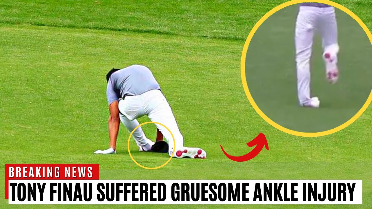 Tony Finau’s Infamous Masters Injury Was Even Worse Than People ...