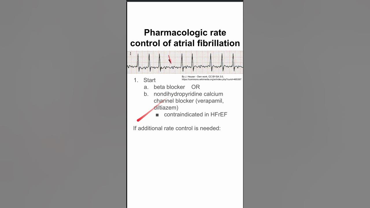 Pharmacologic rate control of atrial fibrillation - YouTube