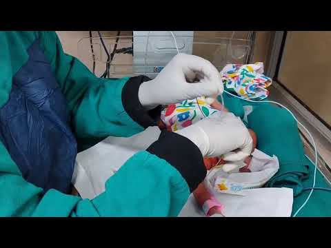 Female catheterization # urine fungal culture #sample collection#aseptic procedure