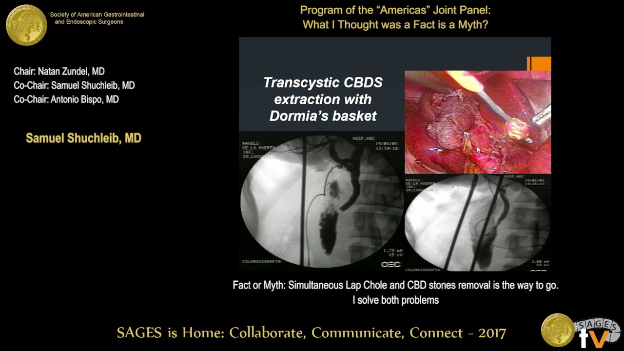 Common bile duct exploration - YouTube