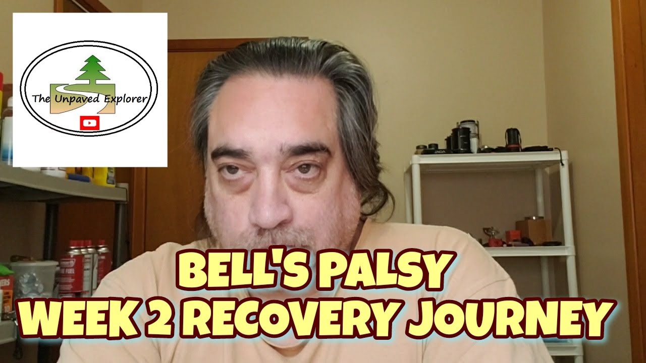 BELL'S PALSY WEEK 2 RECOVERY JOURNEY - YouTube