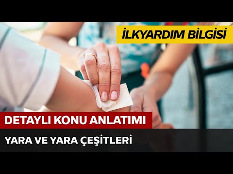 İlkyardım Bilgisi / Yara ve Yara Çeşitleri