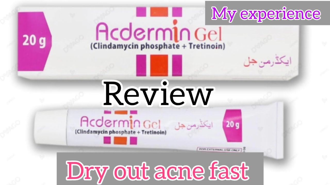 Acdermin gel review -medicated gel for acne - my honest experience ...