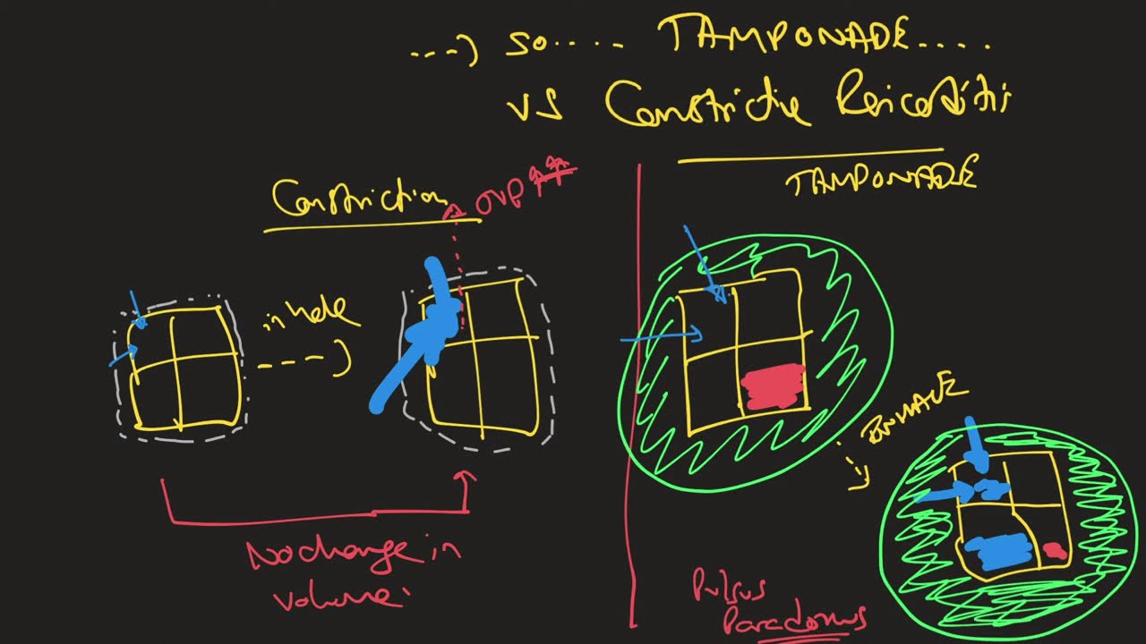 PACES Revision Talks | Intelligent PACES