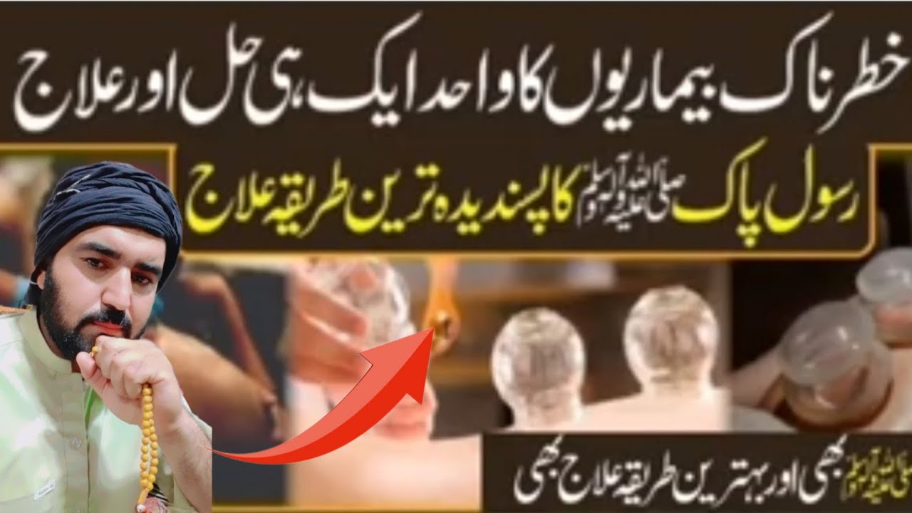 Hijama Lagwane ka Sunnat Tariqa Aur Waqt|Cupping Therapy| Hijama ke ...