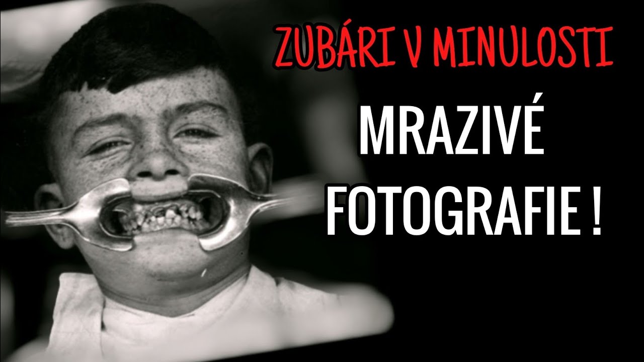 ZUBÁRI V MINULOSTI 🏥 - ODVÁŽILI BY STE SA ? #creepyfacts - YouTube