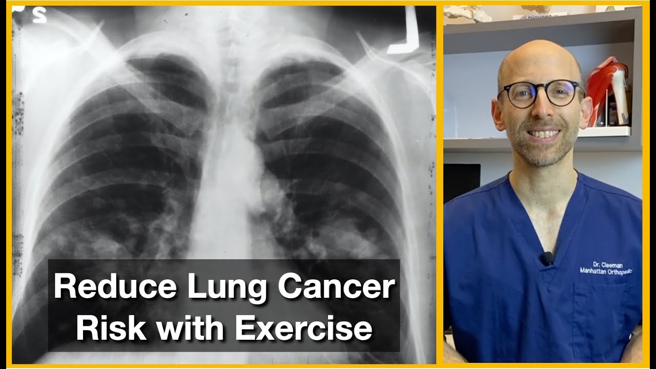 Exercise can reduce risk of Lung Cancer - YouTube