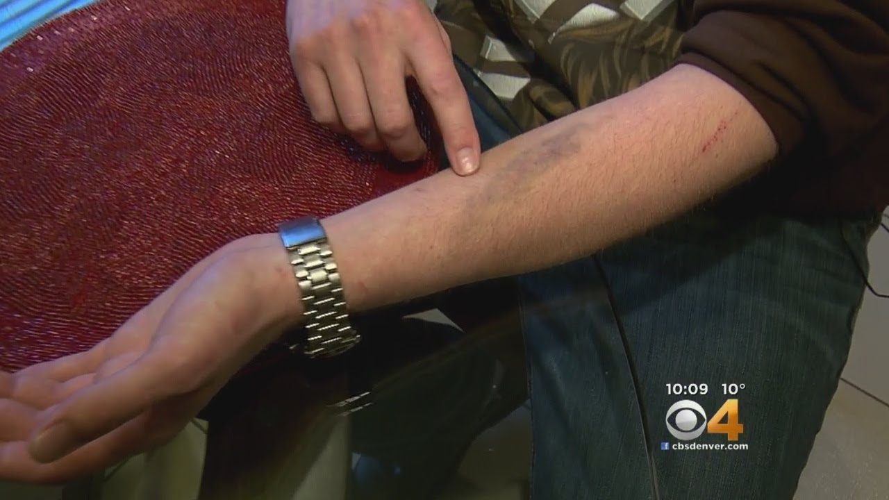 Appliance Repairman Arrested Following Alleged Attack On Homeowner ...