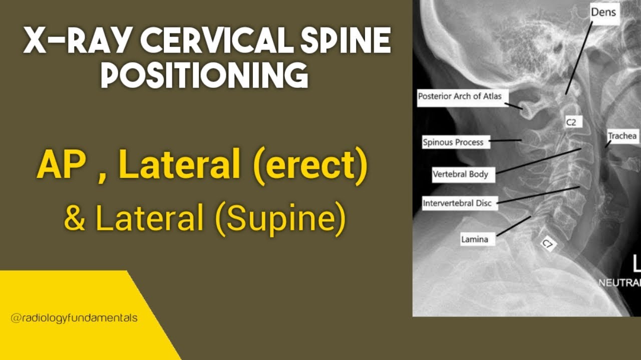 x ray cervical spine ap lateral view | xray anatomy of cervical spine ...