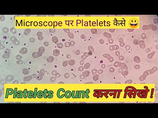 Platelets Slide