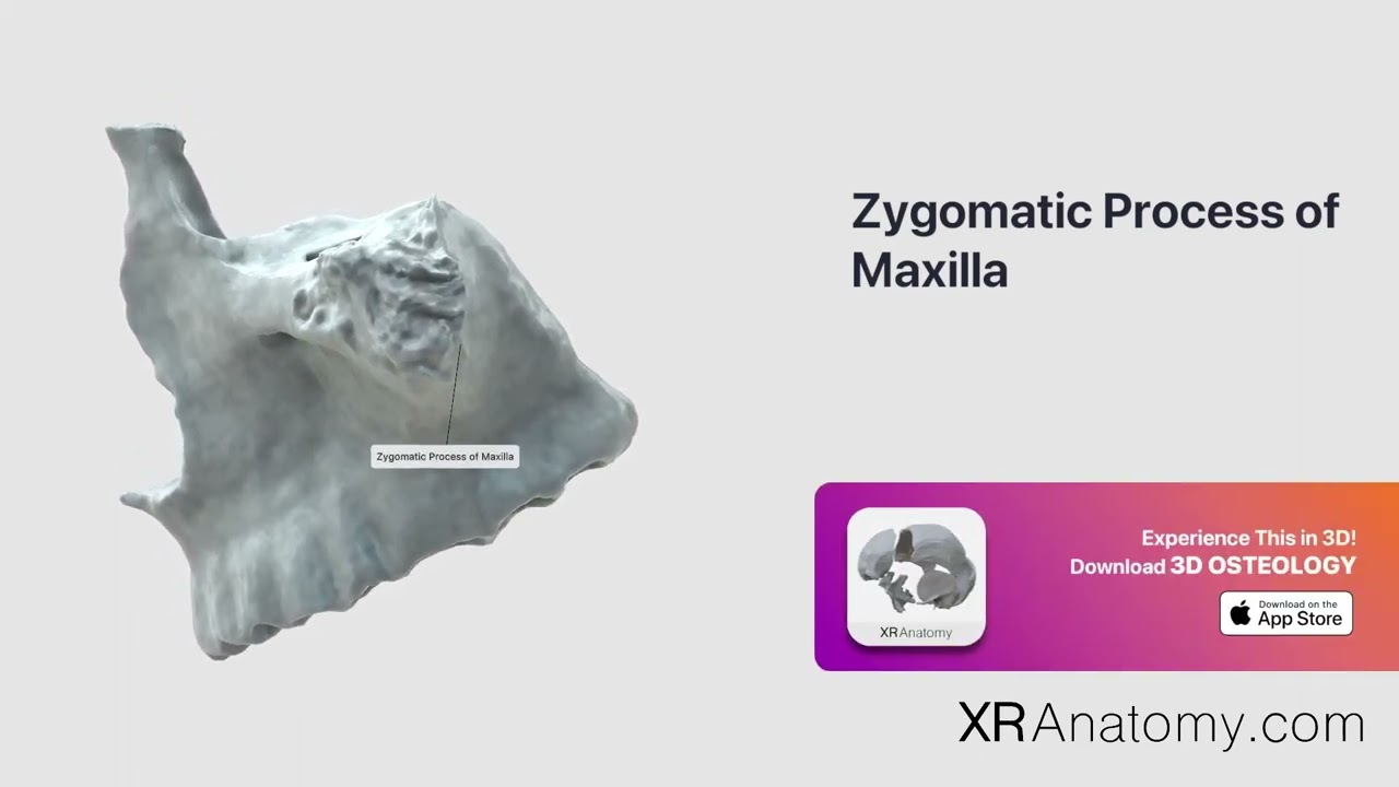 Zygomatic Process Of Maxilla