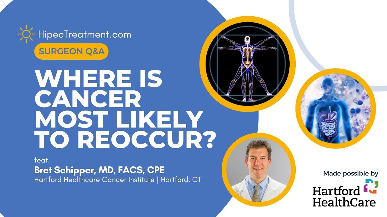 Where is Cancer Most Likely to Reoccur? | Surgeon Q&A with Dr. Bret ...