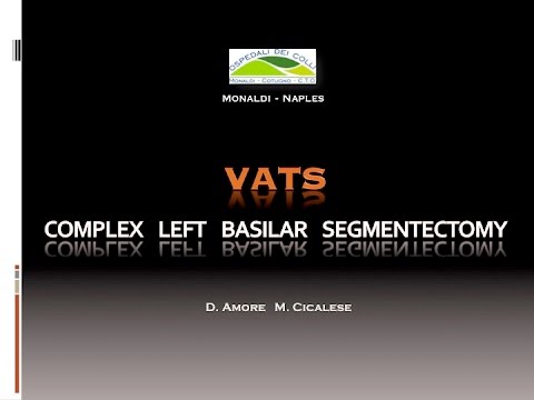 VATS Complex Left Basilar Segmentectomy - YouTube