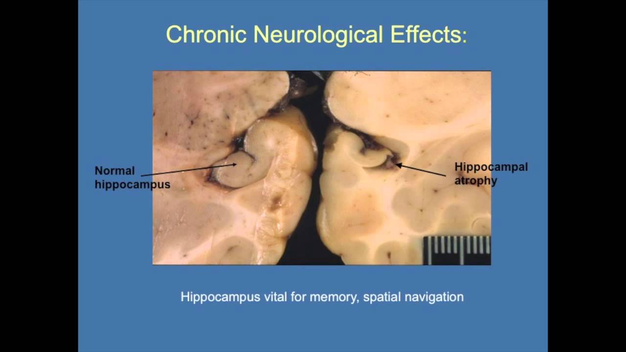 Marine Mammal Health in the Arctic: Frances Gulland: Part 4 - YouTube