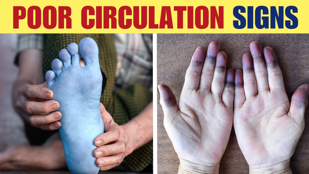 10 Signs You Have Poor Blood Circulation Without Even Realizing It ...