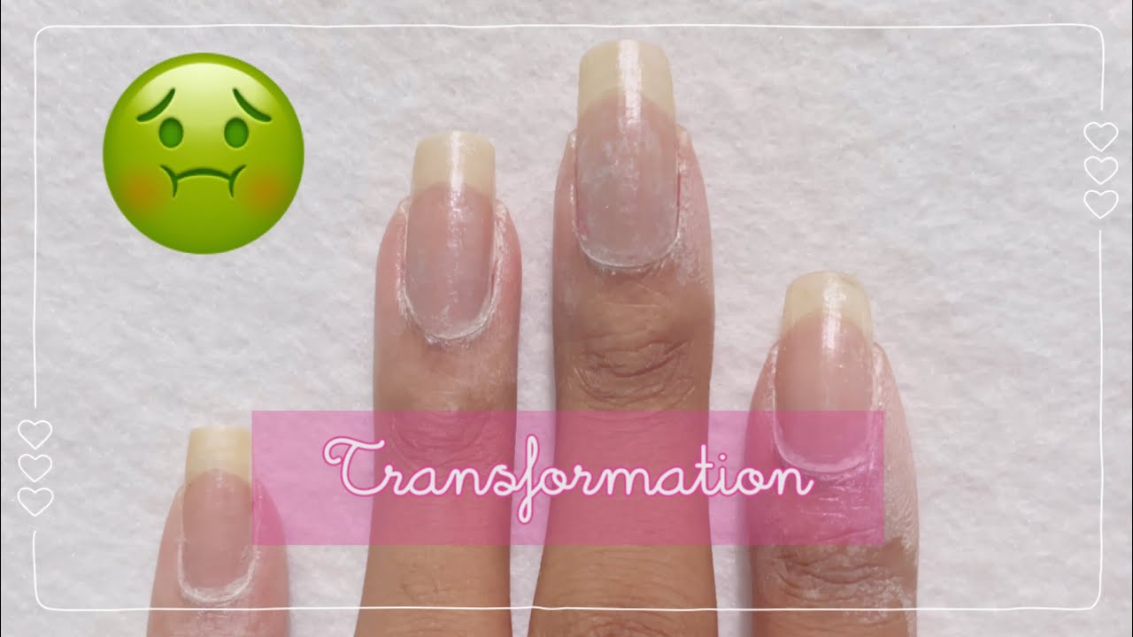 My Nail Manicure Transformation - YouTube