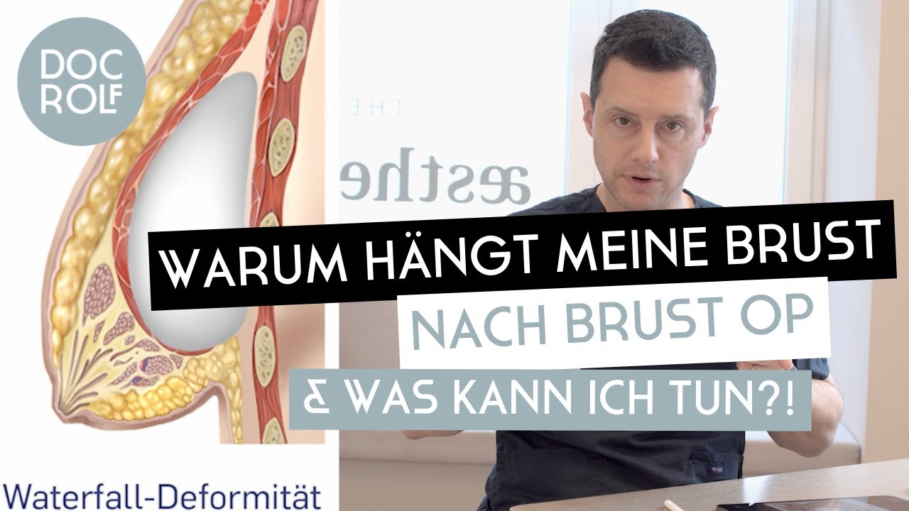HILFE!!! Meine Brust hängt nach Brust OP 😱 – Dr. Rolf Bartsch - YouTube