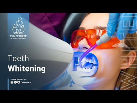 Dişlərin Ağardılması - Turk Aesthetic