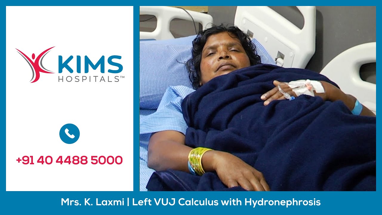 Mrs. K. Laxmi's Testimonial | Left VUJ Calculus with Hydronephrosis |Dr ...