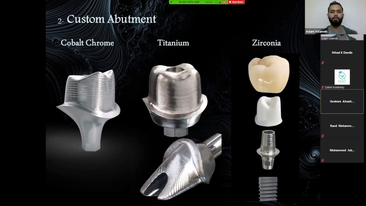 (hybrid implant design at exocad for dental lab)محاضرة ادم سلامة بعنوان ...