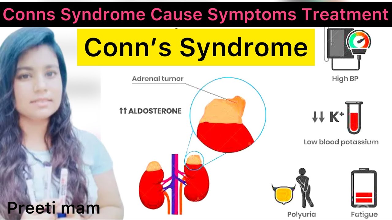 Conns Syndrome Cause Symptoms Diagnose Treatment In Hindi What Is conns-syndrome-cause-symptoms-diagnose-treatment-in-hindi-what-is