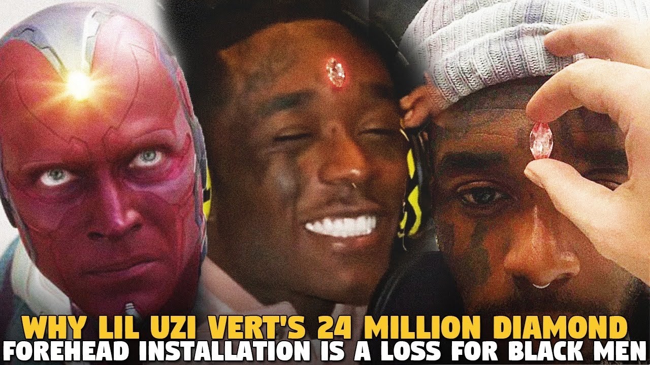 Why Lil Uzi Vert's 24 Million Diamond Forehead Installation is a LOSS ...