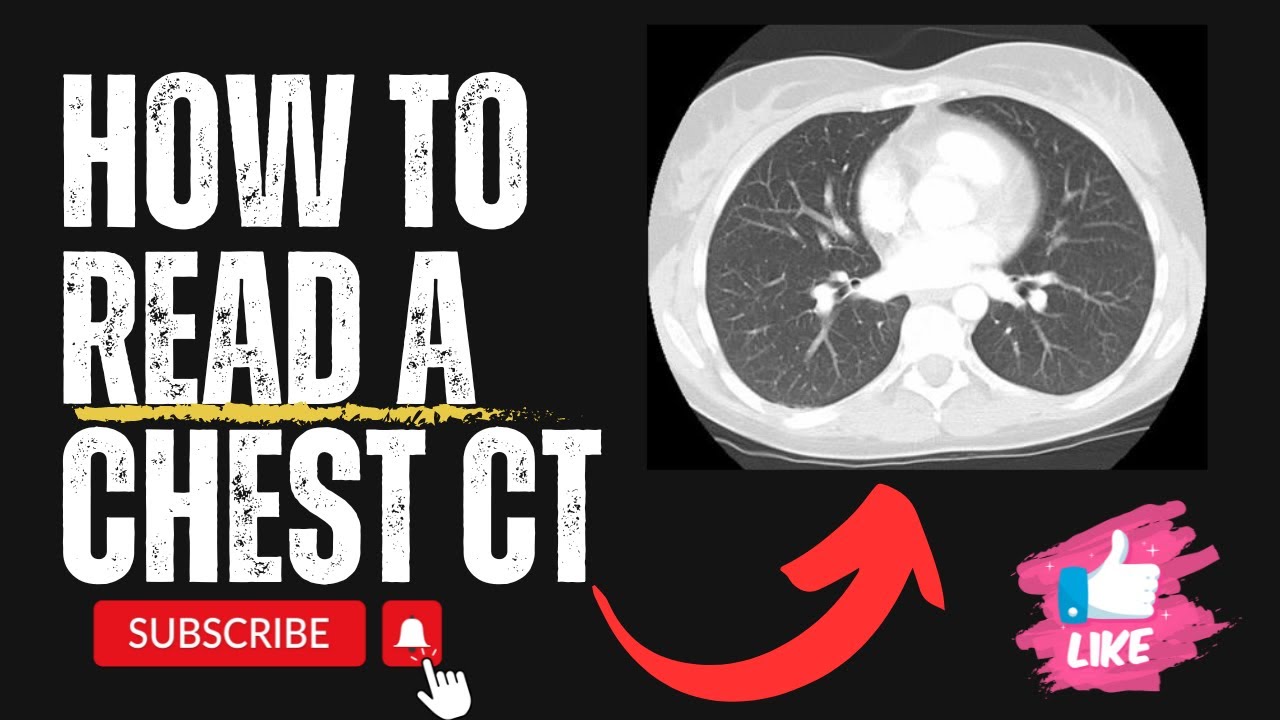 How to Read a Chest CT Scan Like a Radiologist (Beginner's Guide) - YouTube