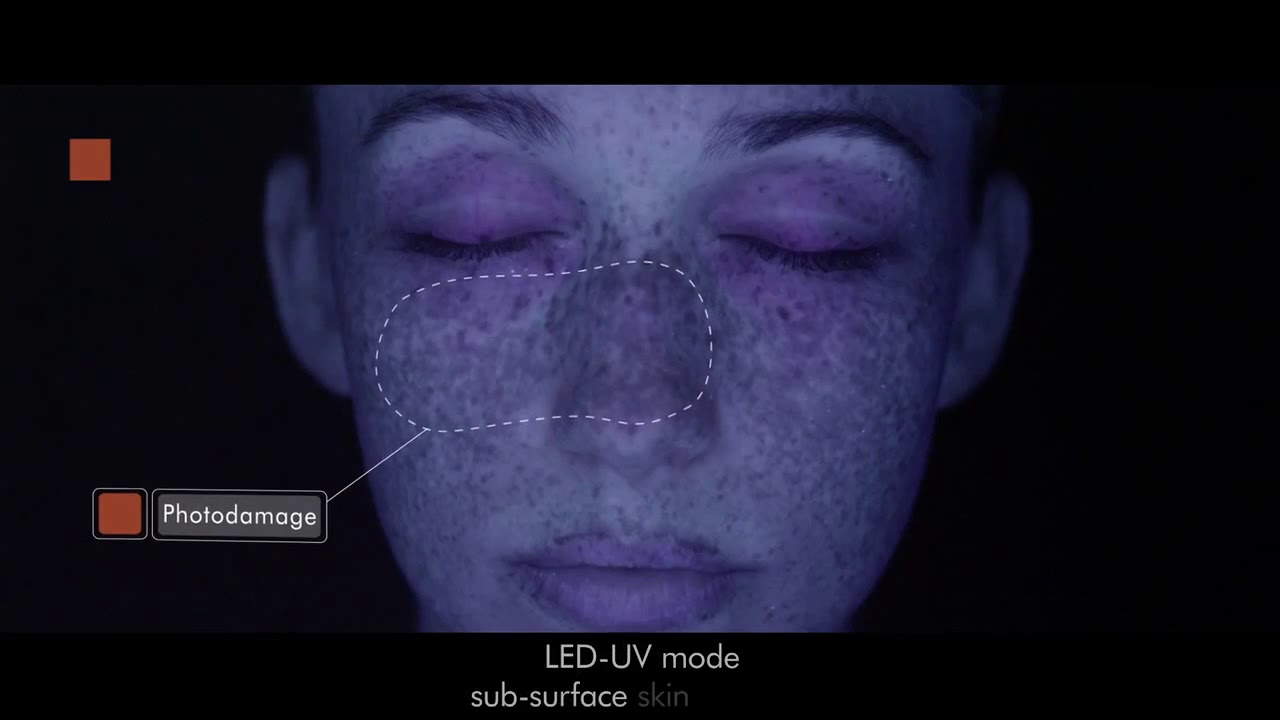 SkinCeuticals LED Skinscope | Charmelle London - YouTube