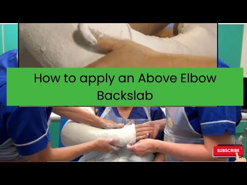 How to apply an Above Elbow Backslab - YouTube