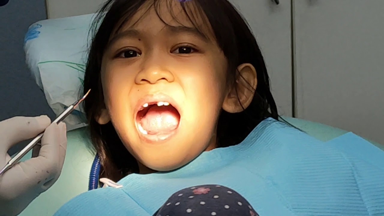 Arissa jumpa doktor gigi, kena tampal dan cabut gigi - YouTube