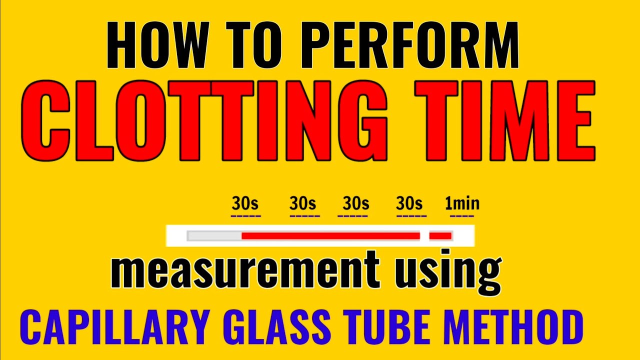 Blood Clotting Time Measurement Using Capillary Glass Tube Method ...