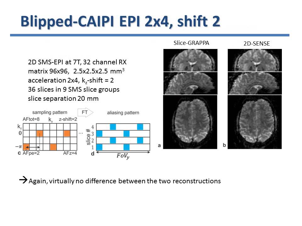 Benjamin Zahneisen: SENSE and Simultaneous Multislice Imaging - YouTube