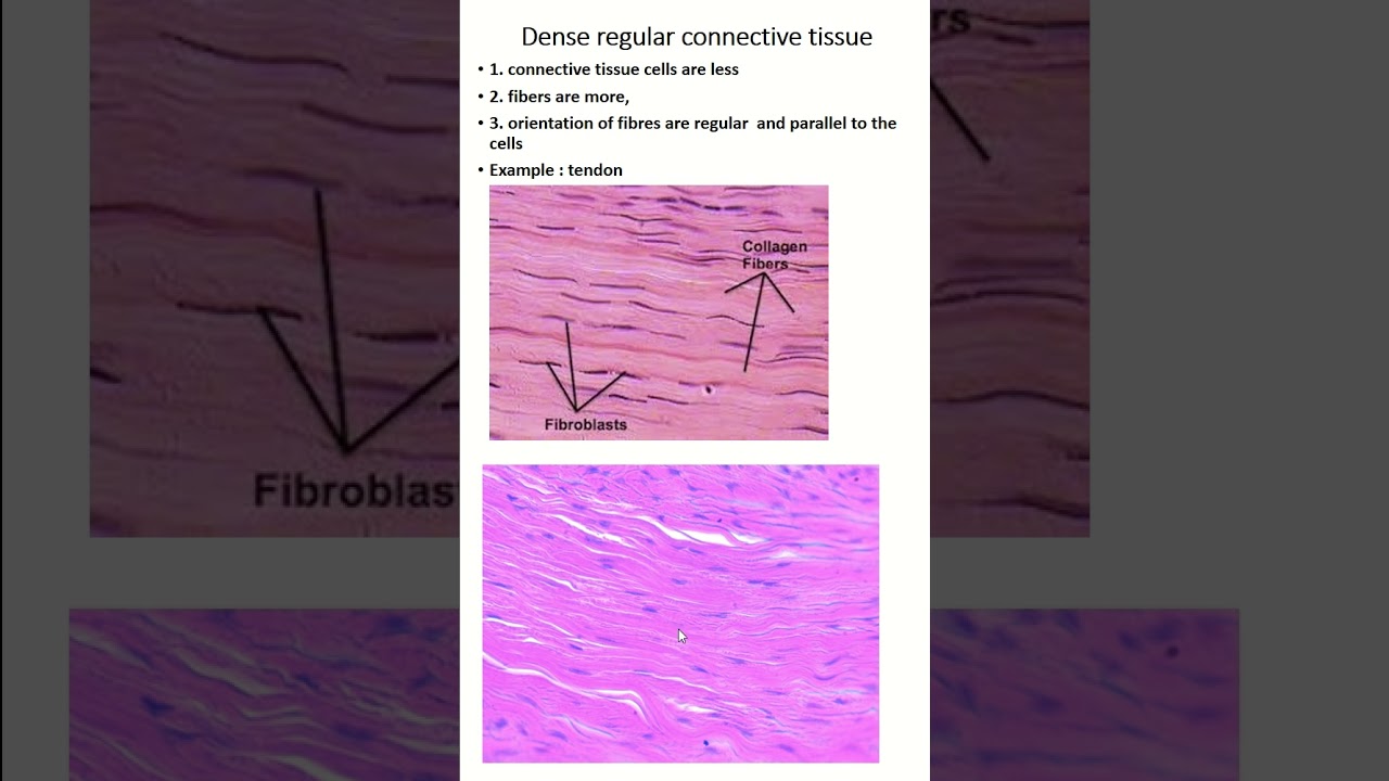 Smooth Muscle Tissue Vs Dense Regular Connective Tissue Solved
