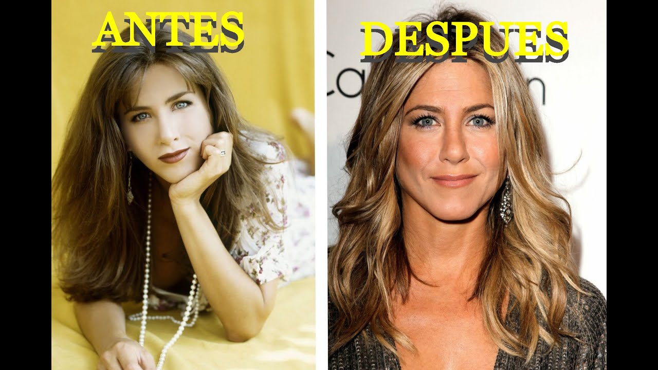 Actrices operadas ANTES y DESPUES! - YouTube