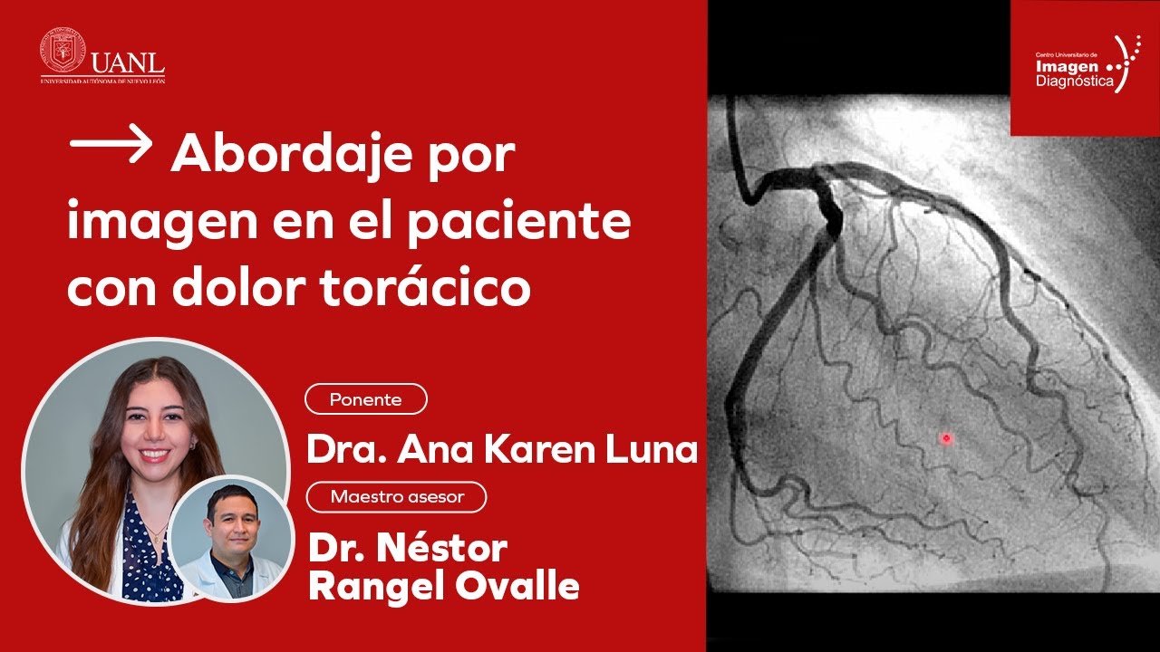 Abordaje por imagen en el paciente con dolor torácico por la Dra. Ana ...