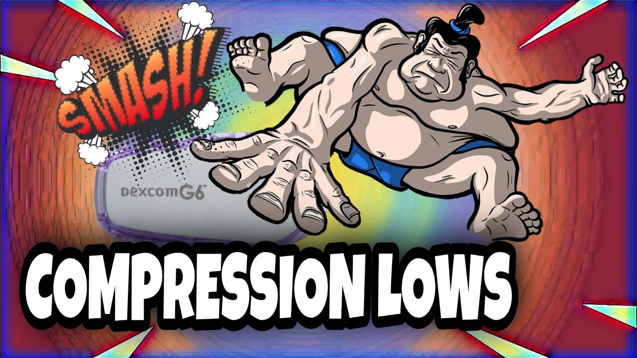 BEWARE! False CGM Readings. Compression Lows Explained - YouTube