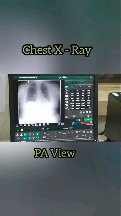 Chest X-Ray PA View | Bsc Radiology | Ucms & Gtbh - YouTube