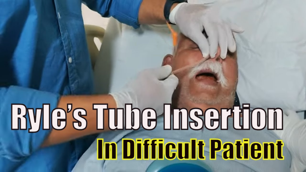 I Learned to Insert Ryle's Tubes Like a PRO in Just Minutes! - YouTube