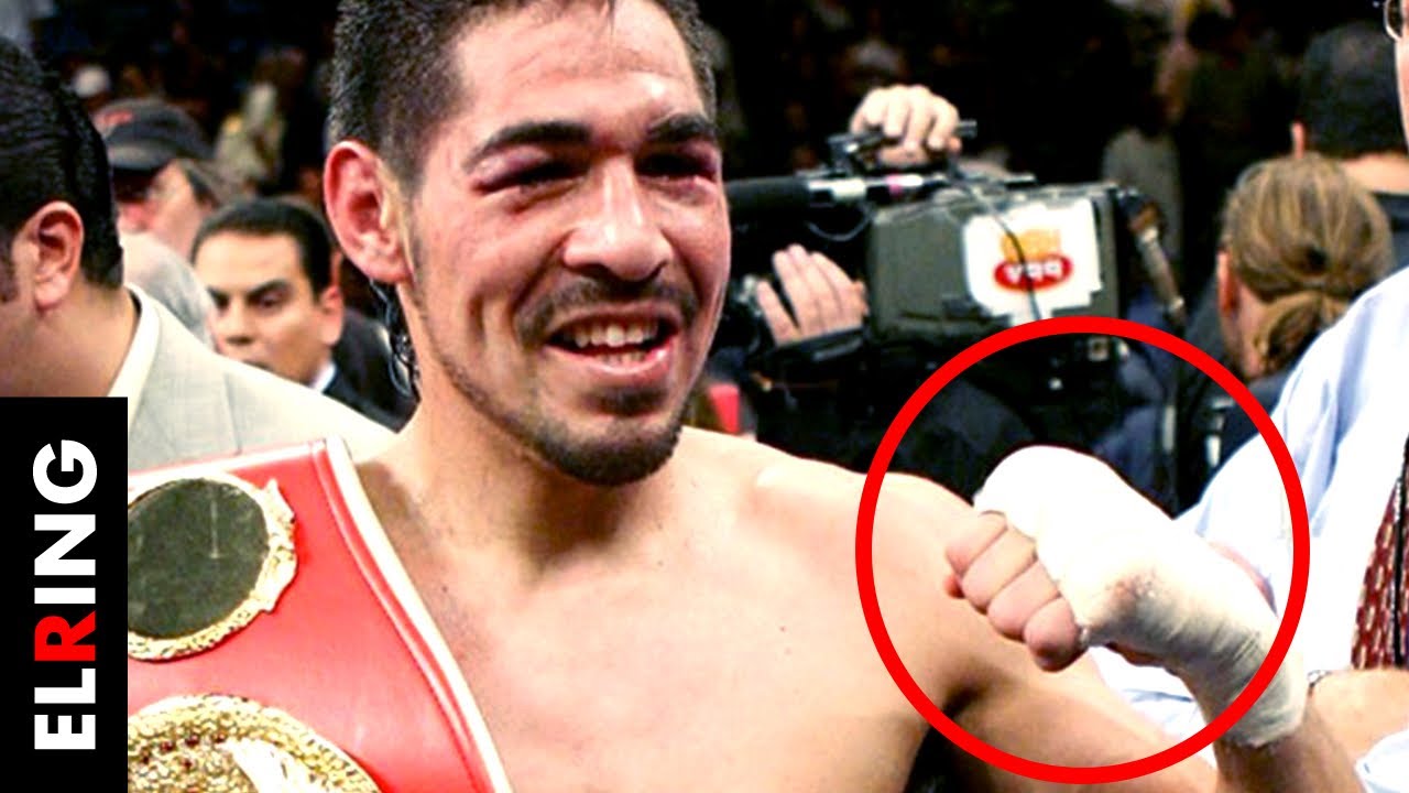 Antonio Margarito, el boxeador más tramposo de la historia | Cracks ...