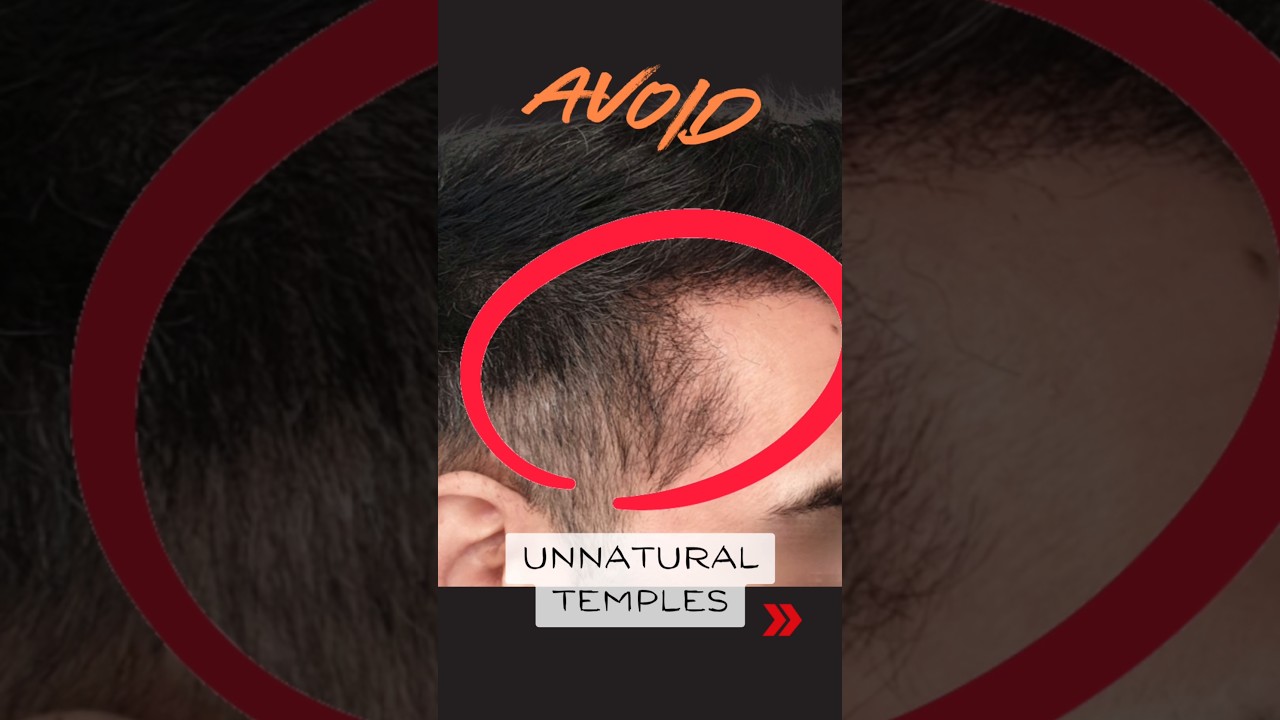 BHR Clinic – Hair Transplant – BHR Clinic