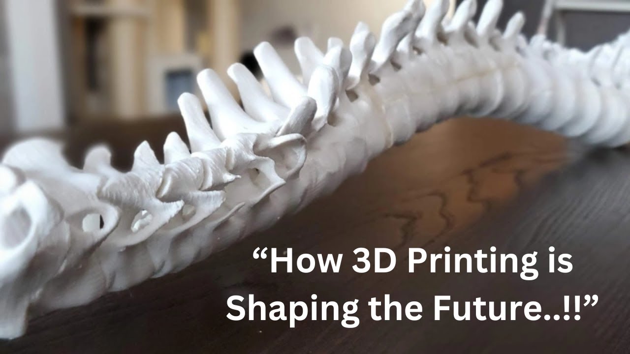 "Revolutionizing Spinal Implants: How 3D Printing is Shaping the Future ...